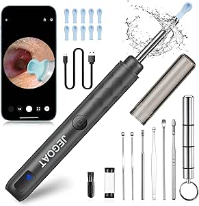 Amazon.com: Ear Wax Removal Tool Camera, Ear Cleaner with Camera, Ear ...