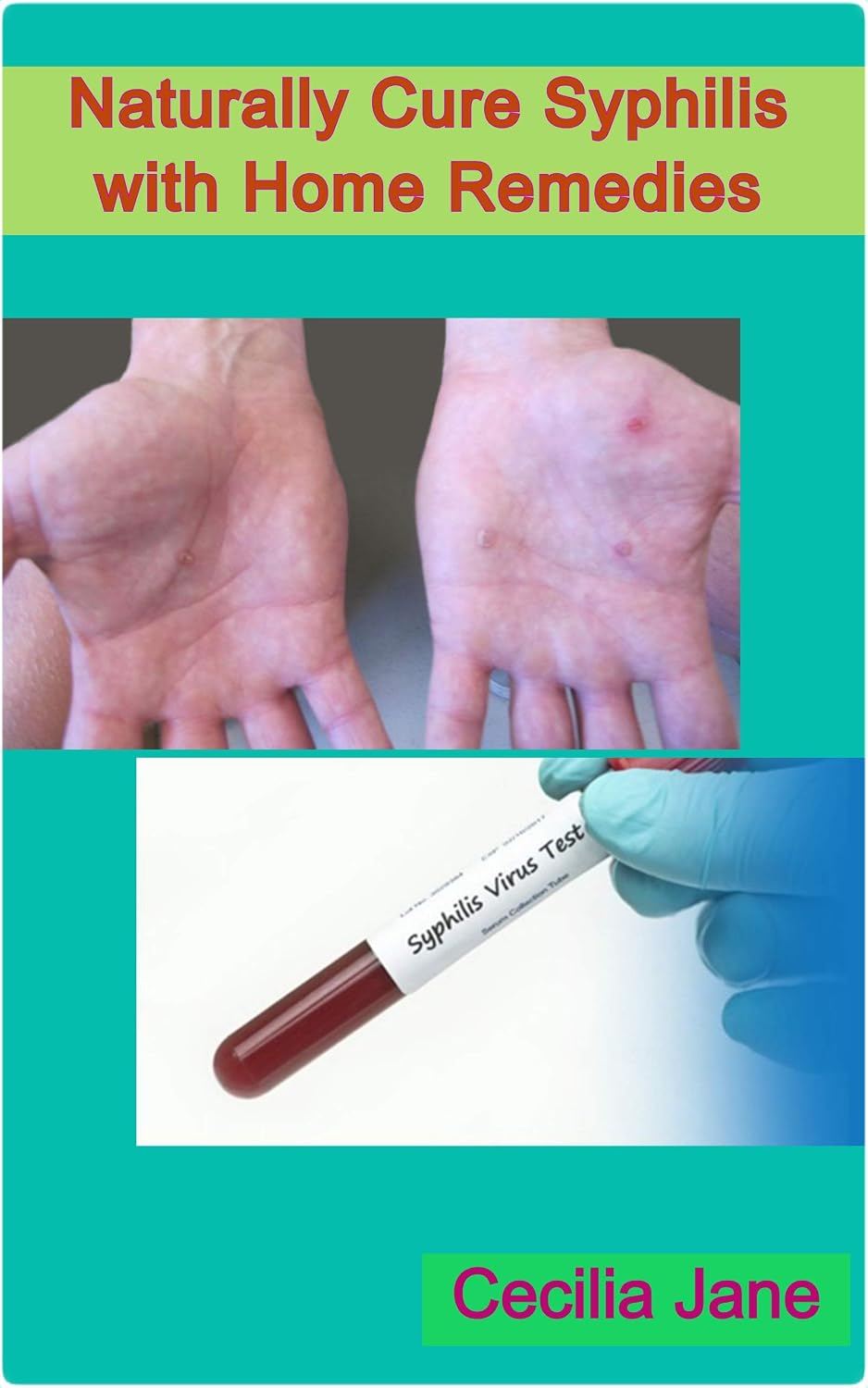 Amazon.com: Naturally Cure Syphilis with Home Remedies eBook : Jane ...
