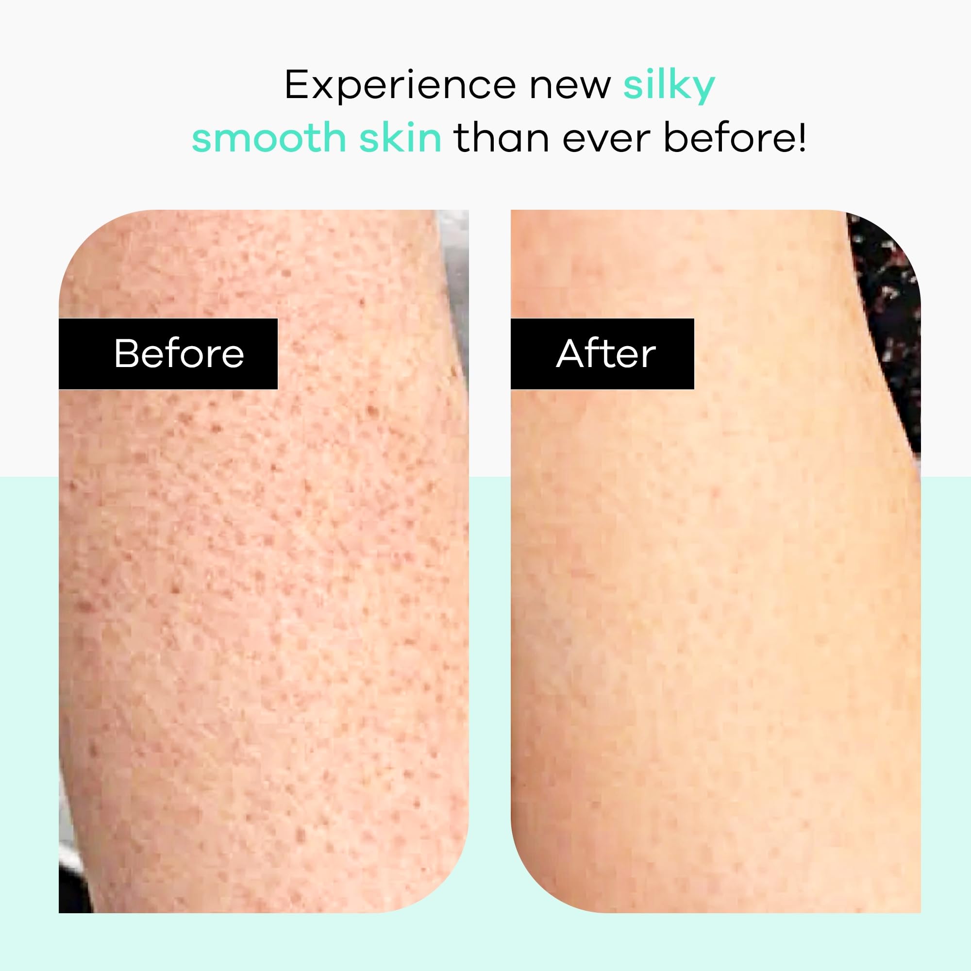 Snapklik.com : Dermasuri Exfoliating Body Lotion - Grapefruit KP Bump ...