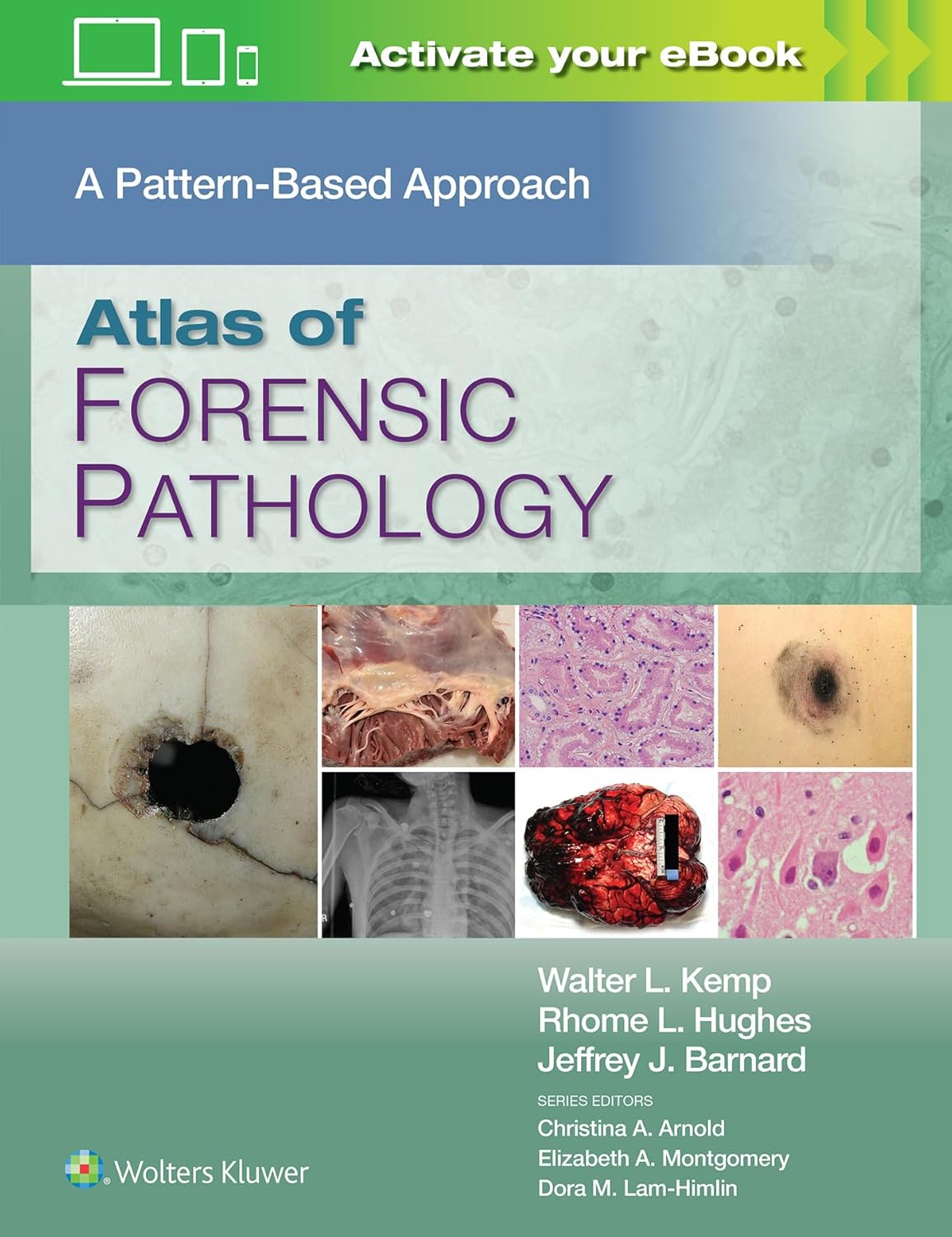 Buy Atlas of Forensic Pathology: A Pattern Based Approach: Print ...