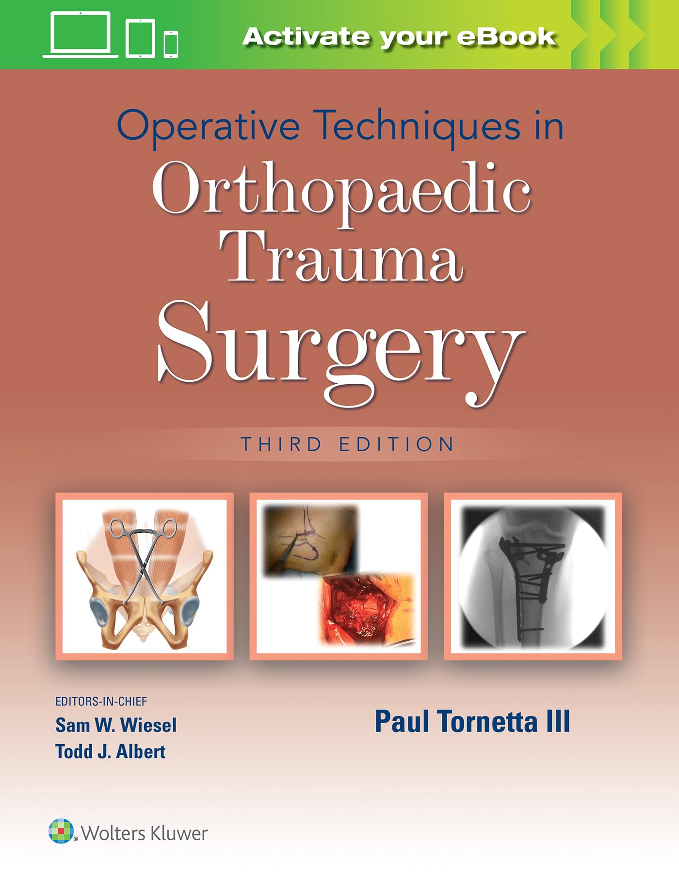 Operative Techniques in Orthopaedic Trauma Surgery: 9781975172039 ...