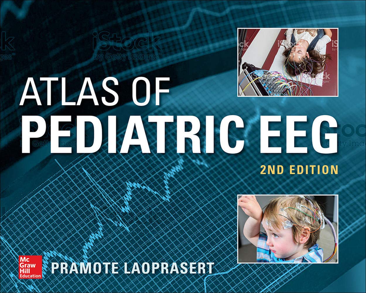 Atlas of Pediatric EEG, 2nd Edition: 9781260117714: Medicine & Health ...