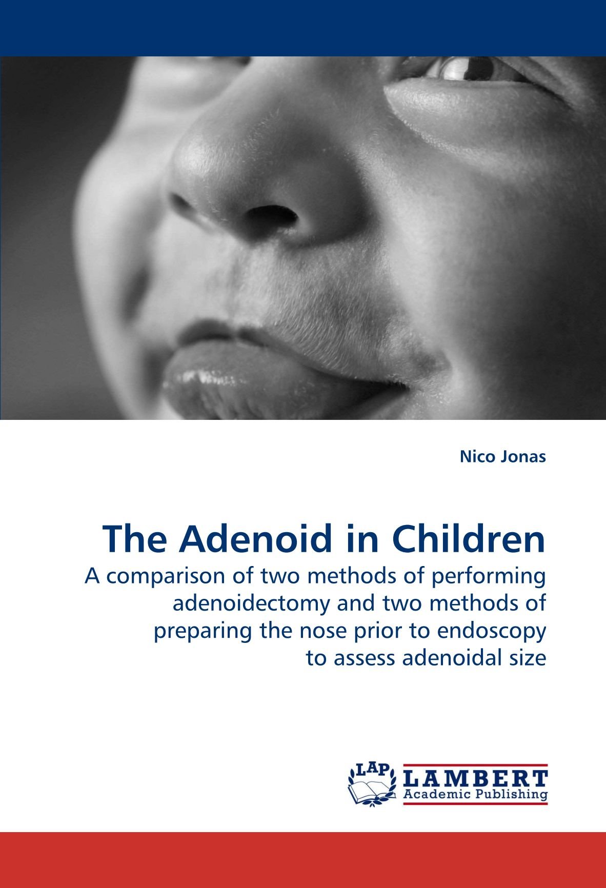 Buy The Adenoid in Children: A comparison of two methods of performing ...