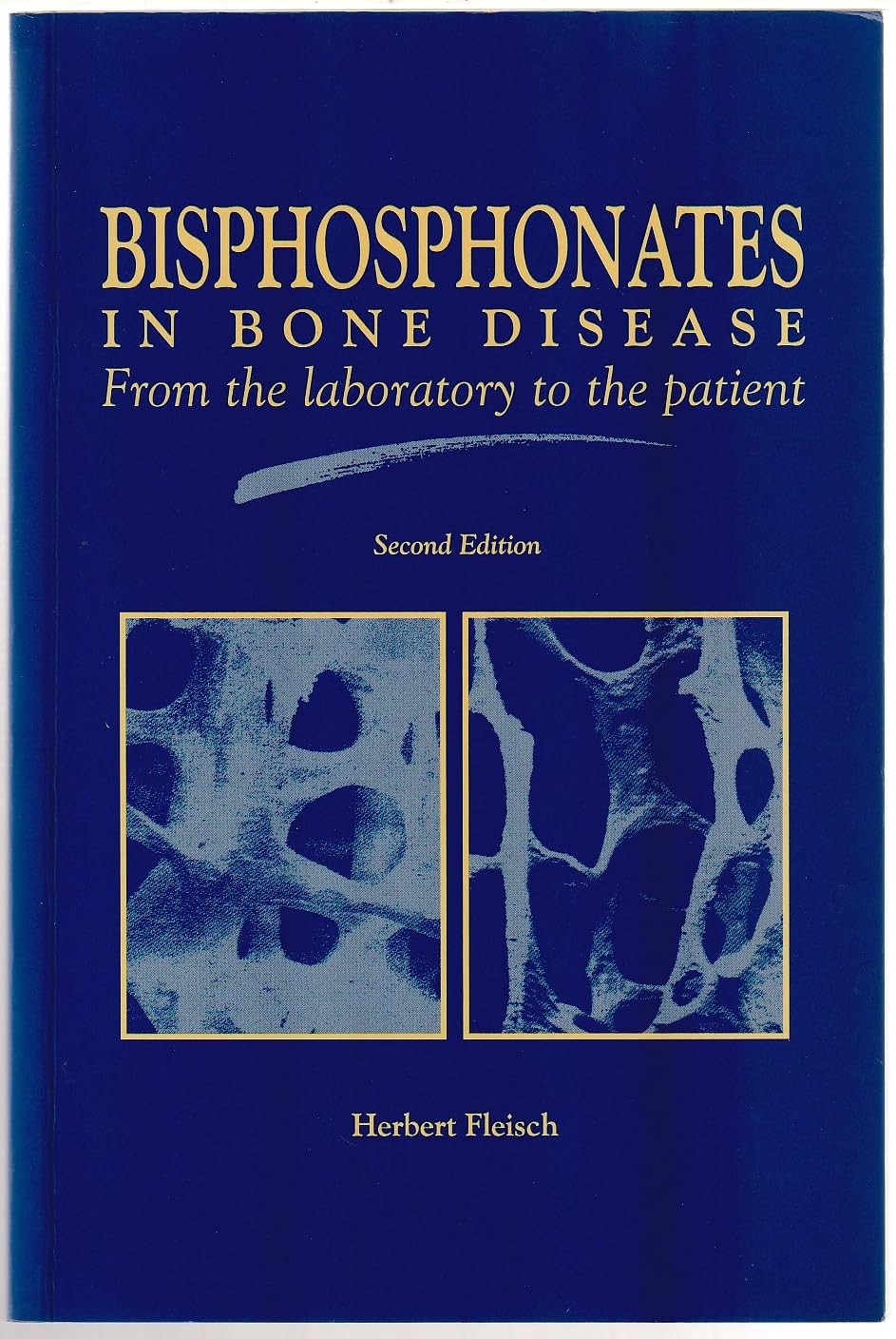 Buy Bisphosphonates in Bone Disease: From the Laboratory to the Patient ...