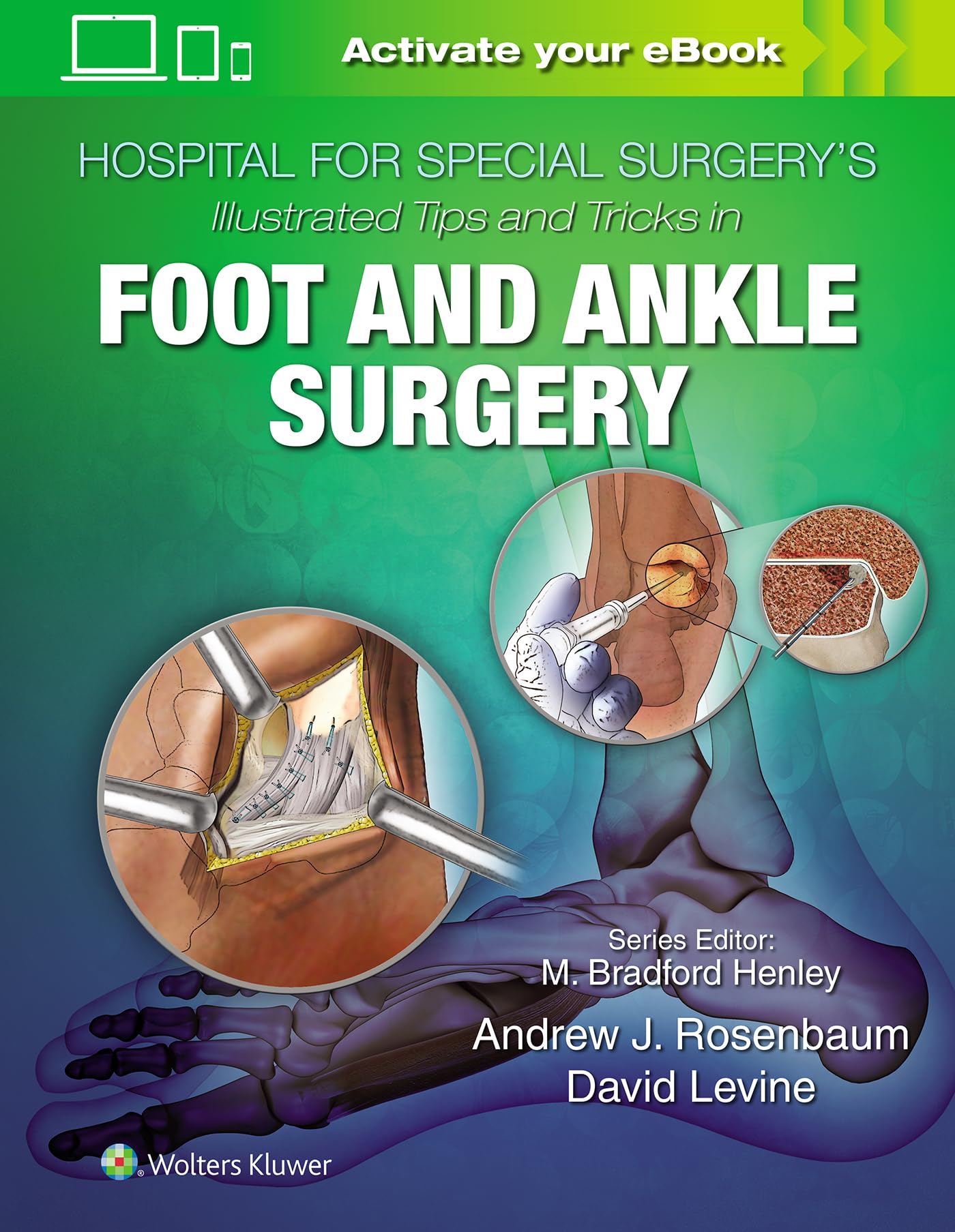 Hospital for Special Surgery's Illustrated Tips and Tricks in Foot and ...