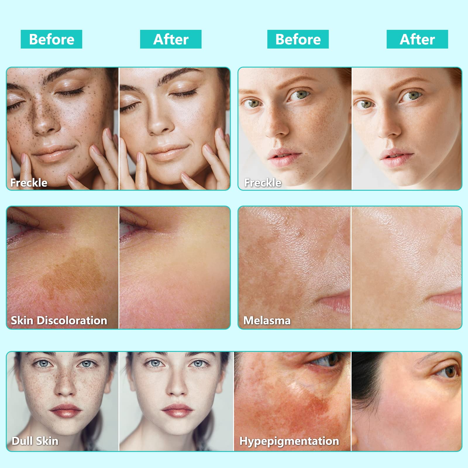 Dull Skin Before After