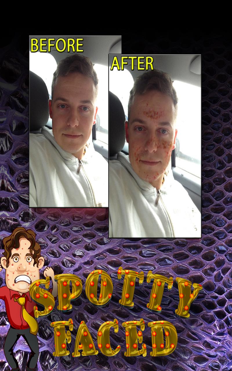 Spotty Faced FX Photo Face Booth Free - App on Amazon Appstore