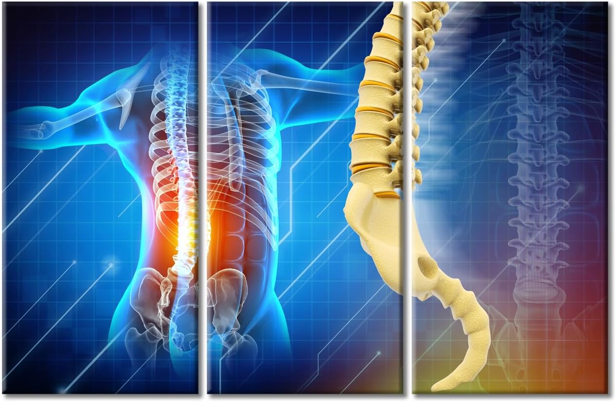 Amazon.com: 3 Panels Pain in the Spine Pain in the Back Lumbar Spine ...