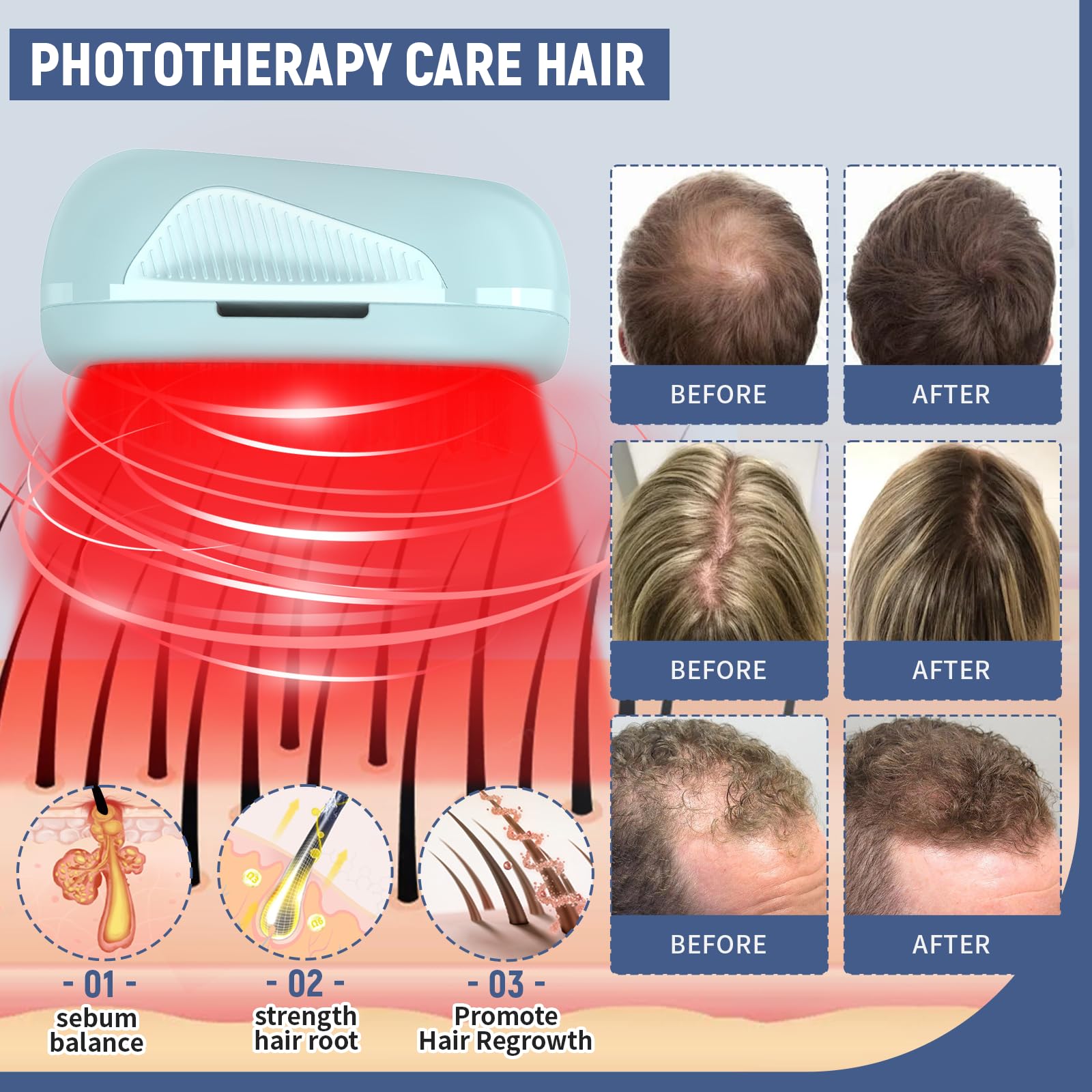Red Light Therapy Hair Regrowth Searching For Ways To Optimize Your