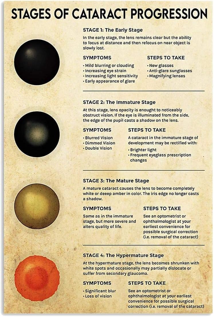 Amazon.com: Retro Metal Tin Sign 8 X 12 Inches Stages of Cataract ...