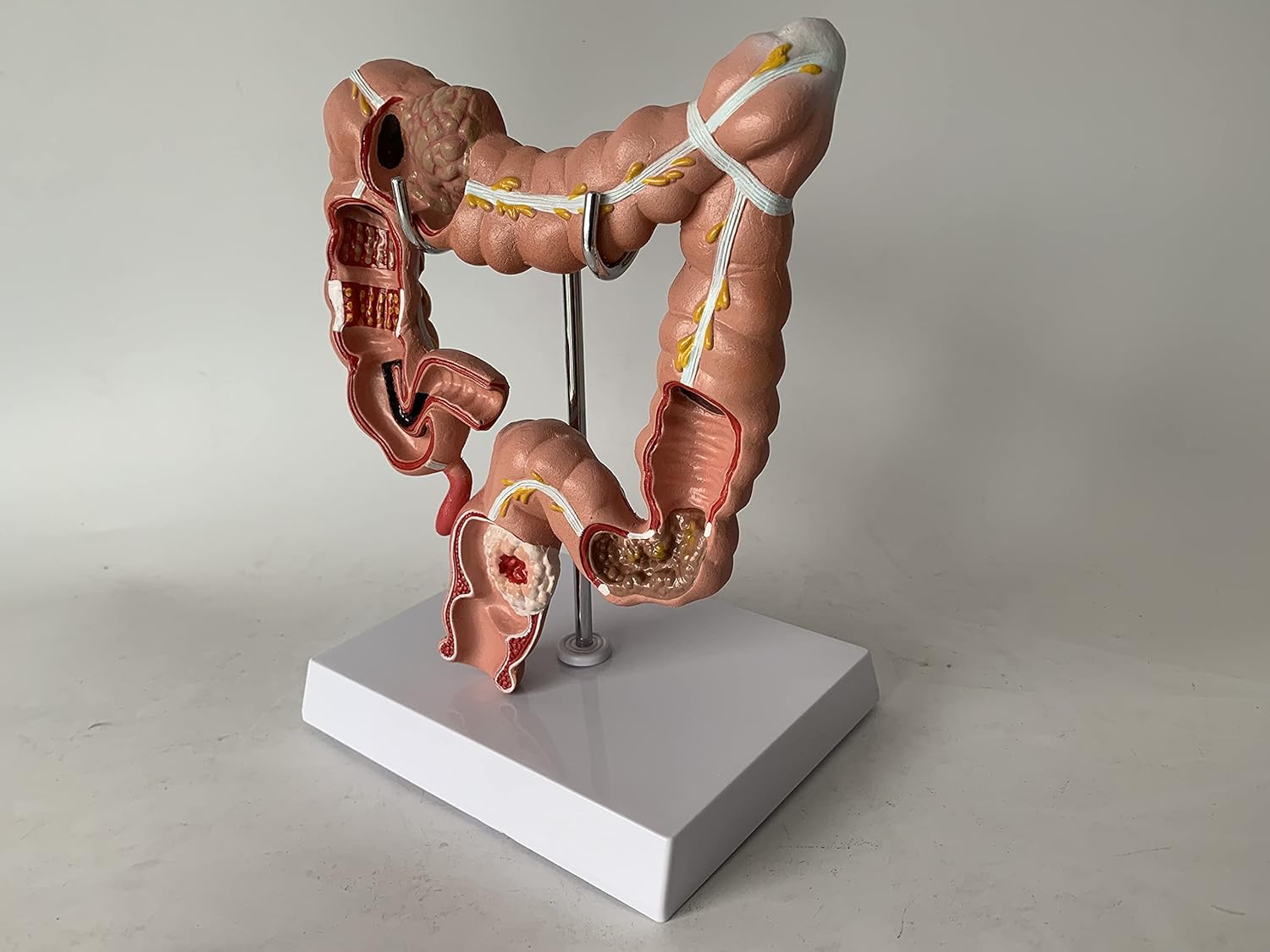 Human Large Intestine Anatomical Model Colon Philippines | Ubuy