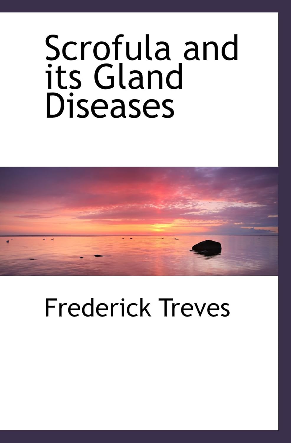 Scrofula and its Gland Diseases : Amazon.in: Books