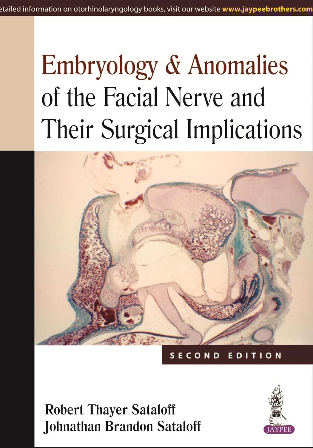 Embryology & Anomalies of the Facial Nerve and Their Surgical ...