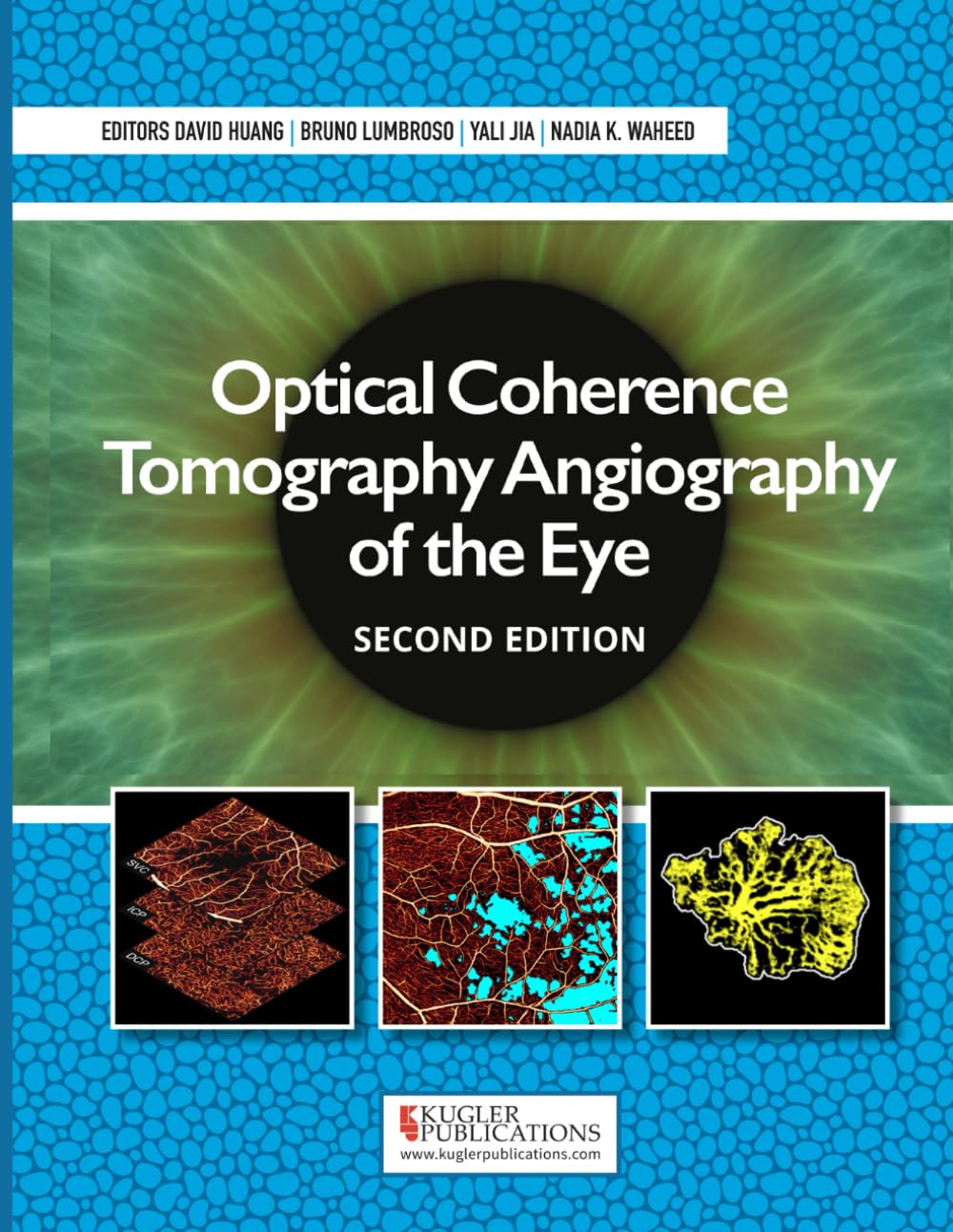 Optical Coherence Tomography Angiography of the Eye: 9789062993079 ...