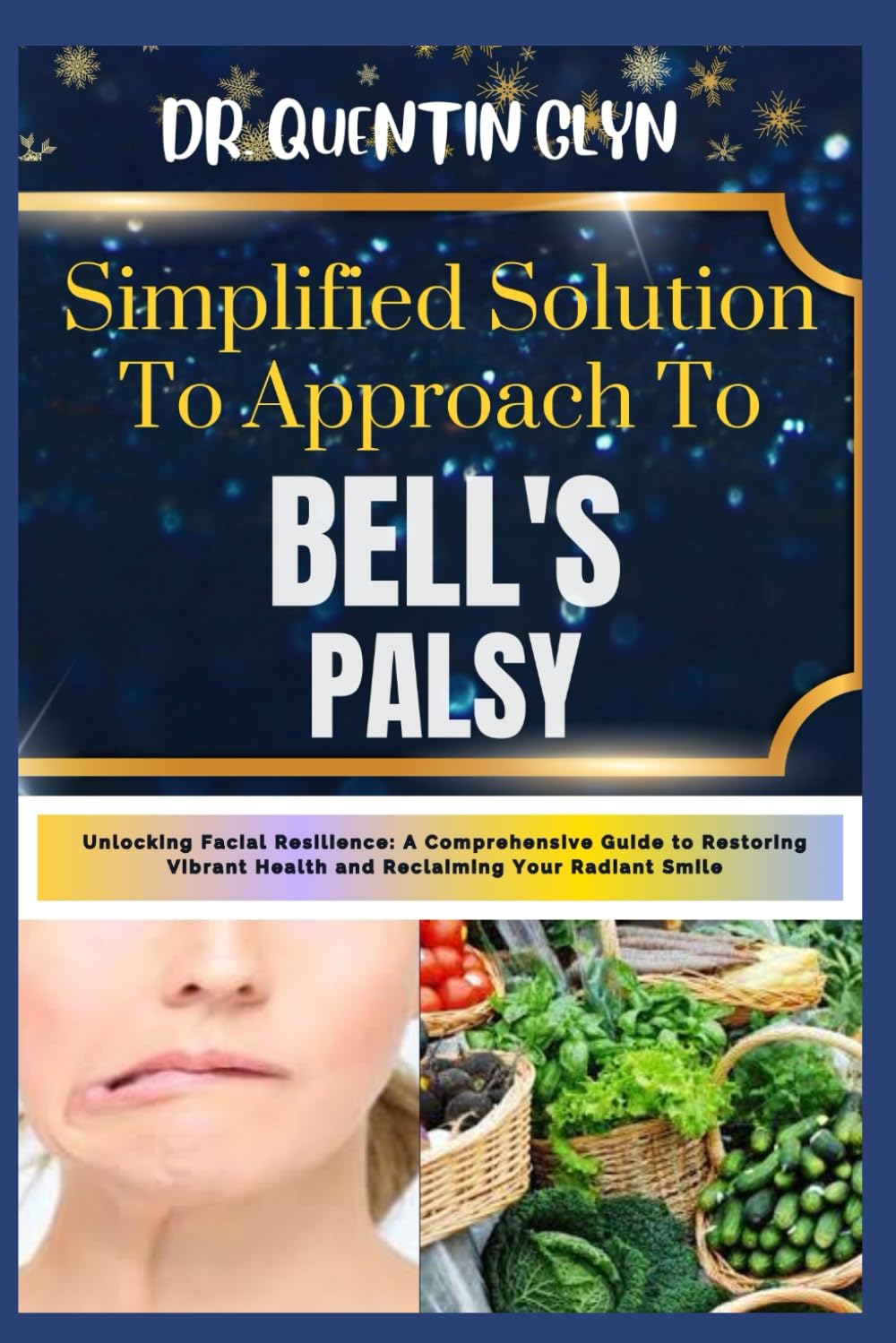 Simplified Solution Approach To BELL'S PALSY: Unlocking Facial Resilience: A Comprehensive Guide ...