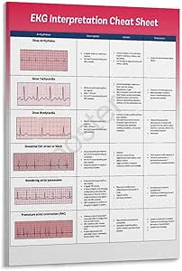 Amazon.com: TOEJGF EKG Knowledge Poster Basic ECG Heart Rhythms ...