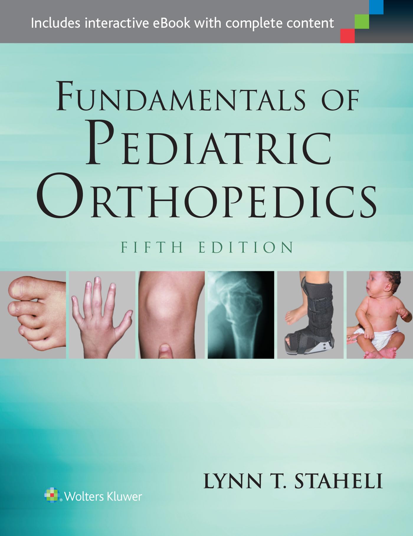 Fundamentals of Pediatric Orthopedics (Staheli, Fundamentals of ...