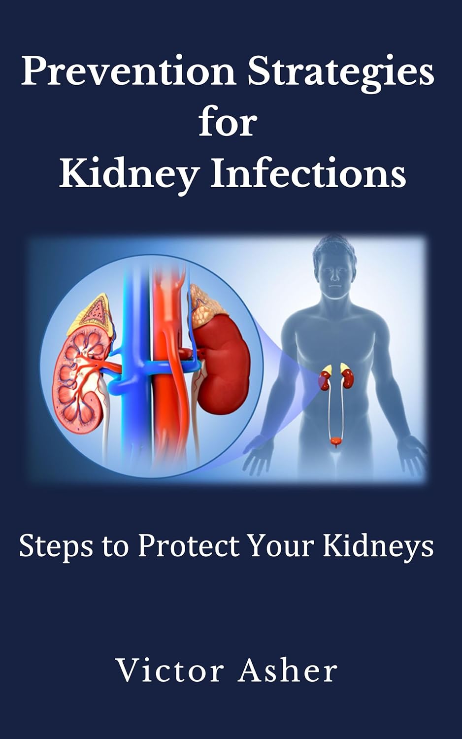 Prevention Strategies for Kidney Infections : Steps to Protect Your ...