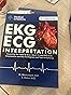 EKG/ECG Interpretation: Everything you Need to Know about the 12 - Lead ...