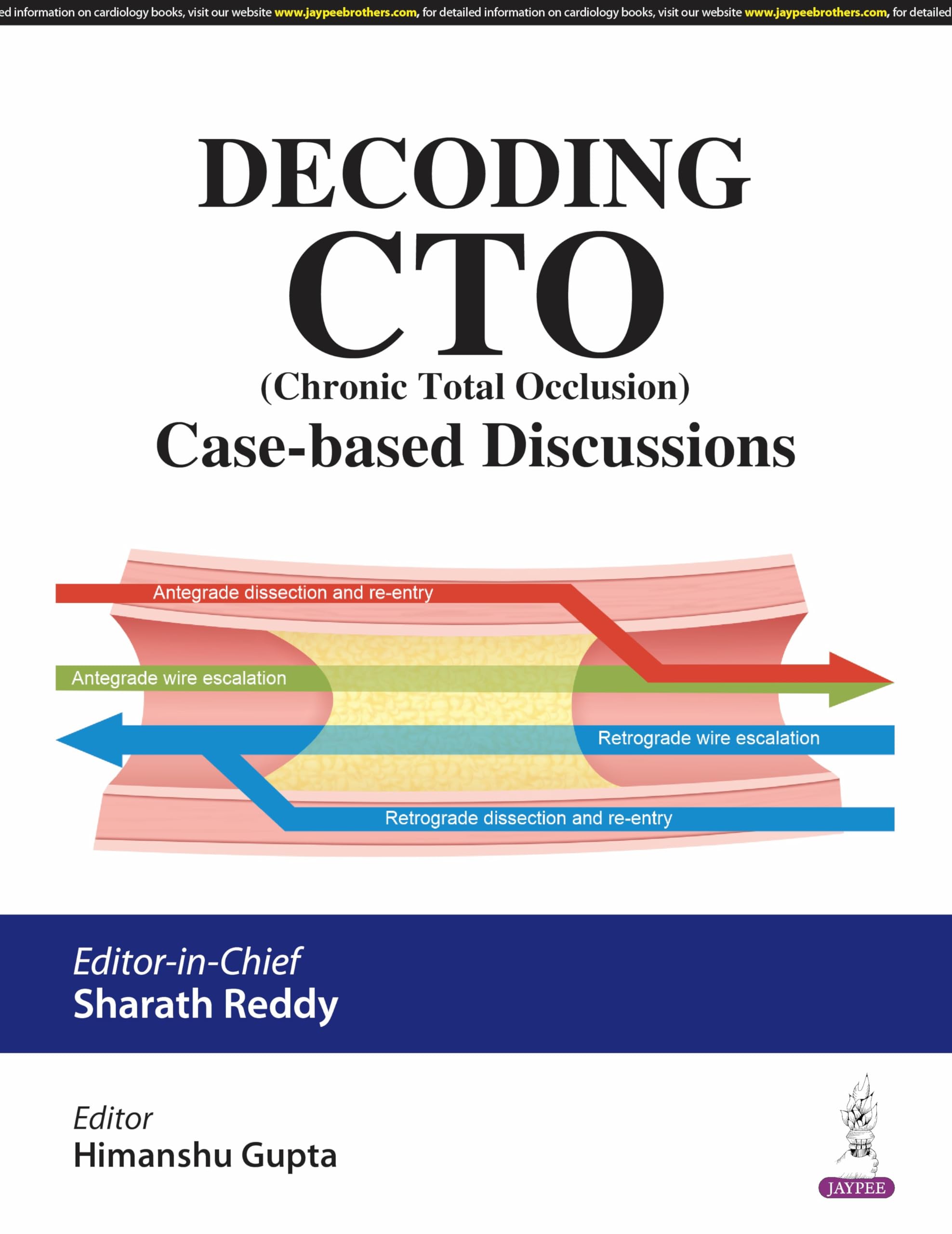 Buy Decoding CTO (Chronic Total Occlusion) Case-Based Discussions Book ...