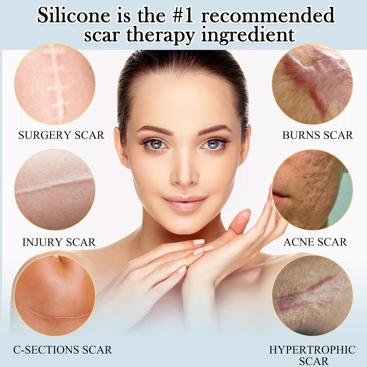 Silicone Scar Gel, Medical Scar Treatment Cream 100% Silicone for ...