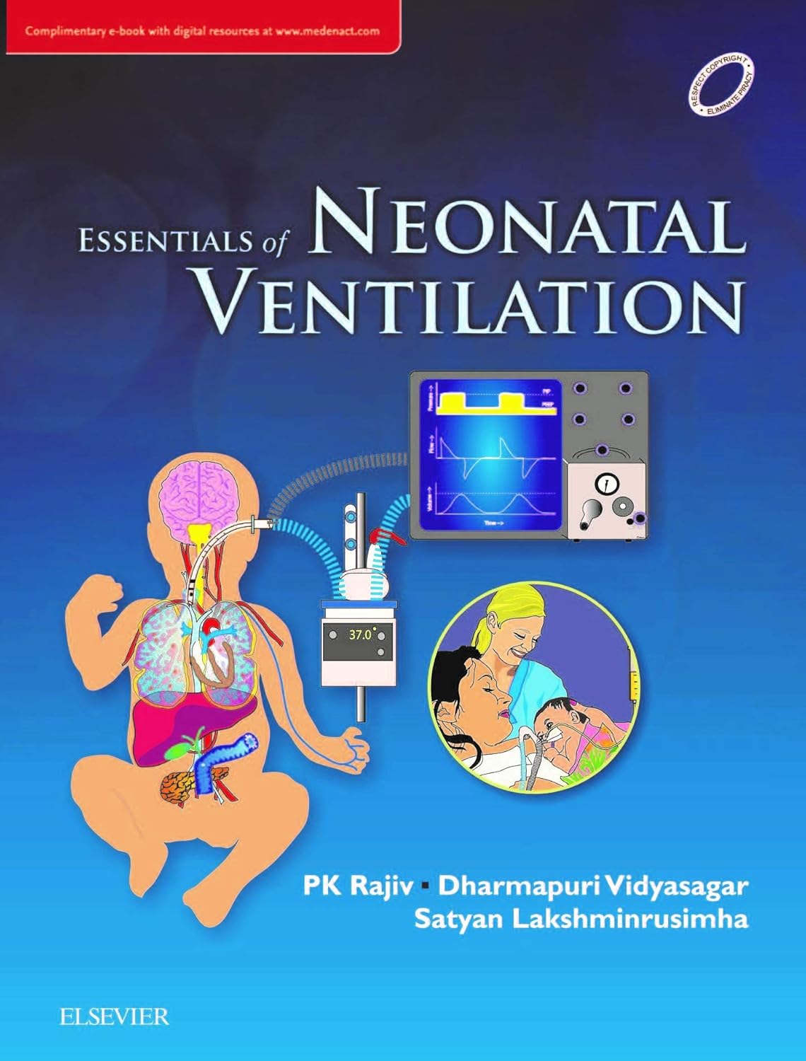 Essentials of Neonatal Ventilation, 1st edition: 9788131249987 ...