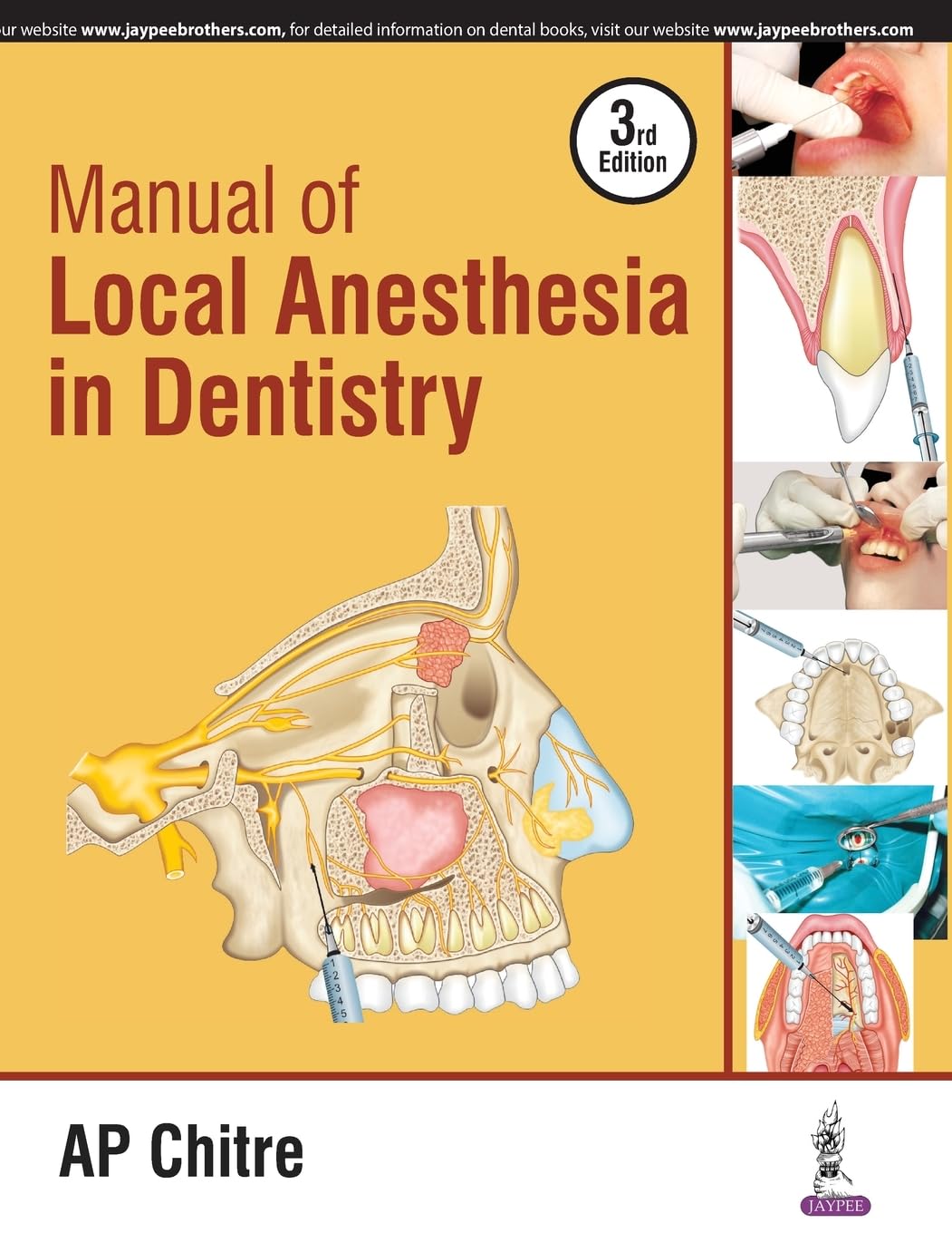 Buy Manual of Local Anesthesia in Dentistry Book Online at Low Prices ...