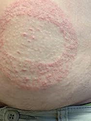 Amazon.com: SIMPATCH Adhesive Patch - Pack of 30 - Multiple Colors ...