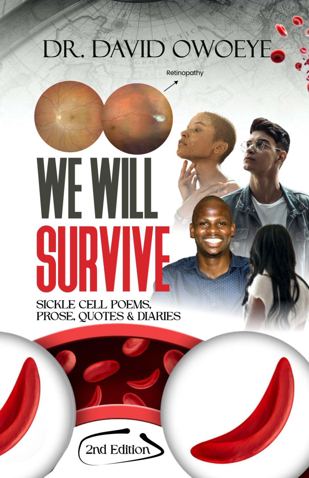 Sickle Cell Anemia Quotes Pinterest