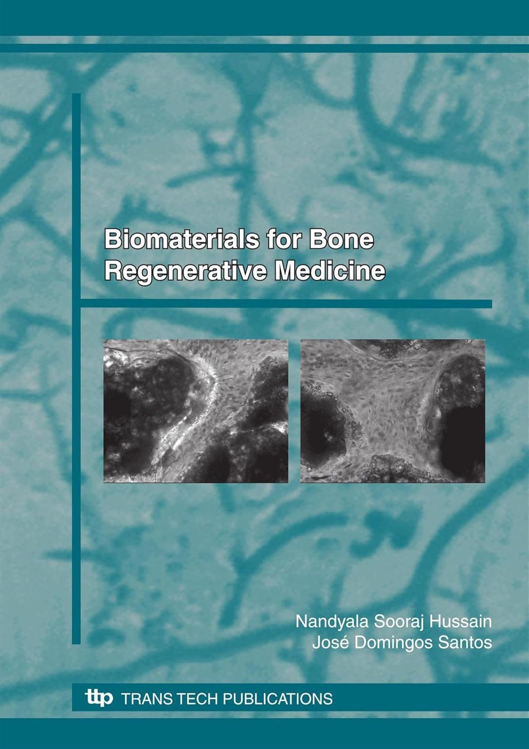 Biomaterials for Bone, Regenerative Medicine (Materials Science ...