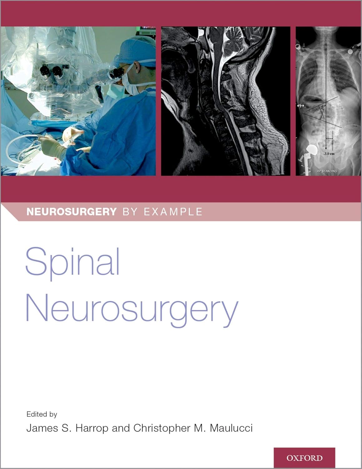 Spinal Neurosurgery (Neurosurgery by Example Book 3) eBook : Harrop, Dr ...