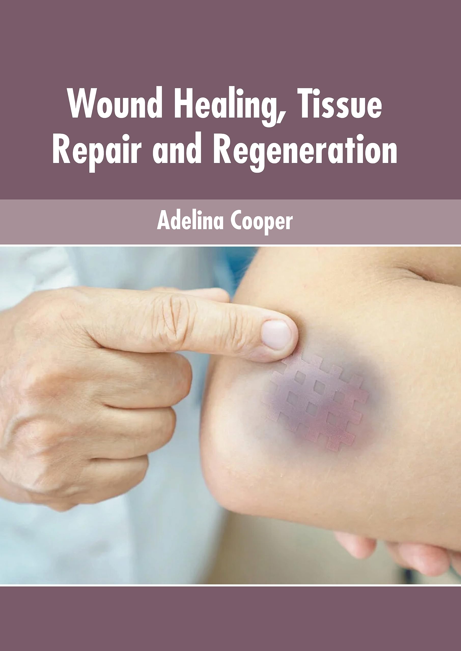 Wound Healing, Tissue Repair and Regeneration: 9781639877652: Medicine ...