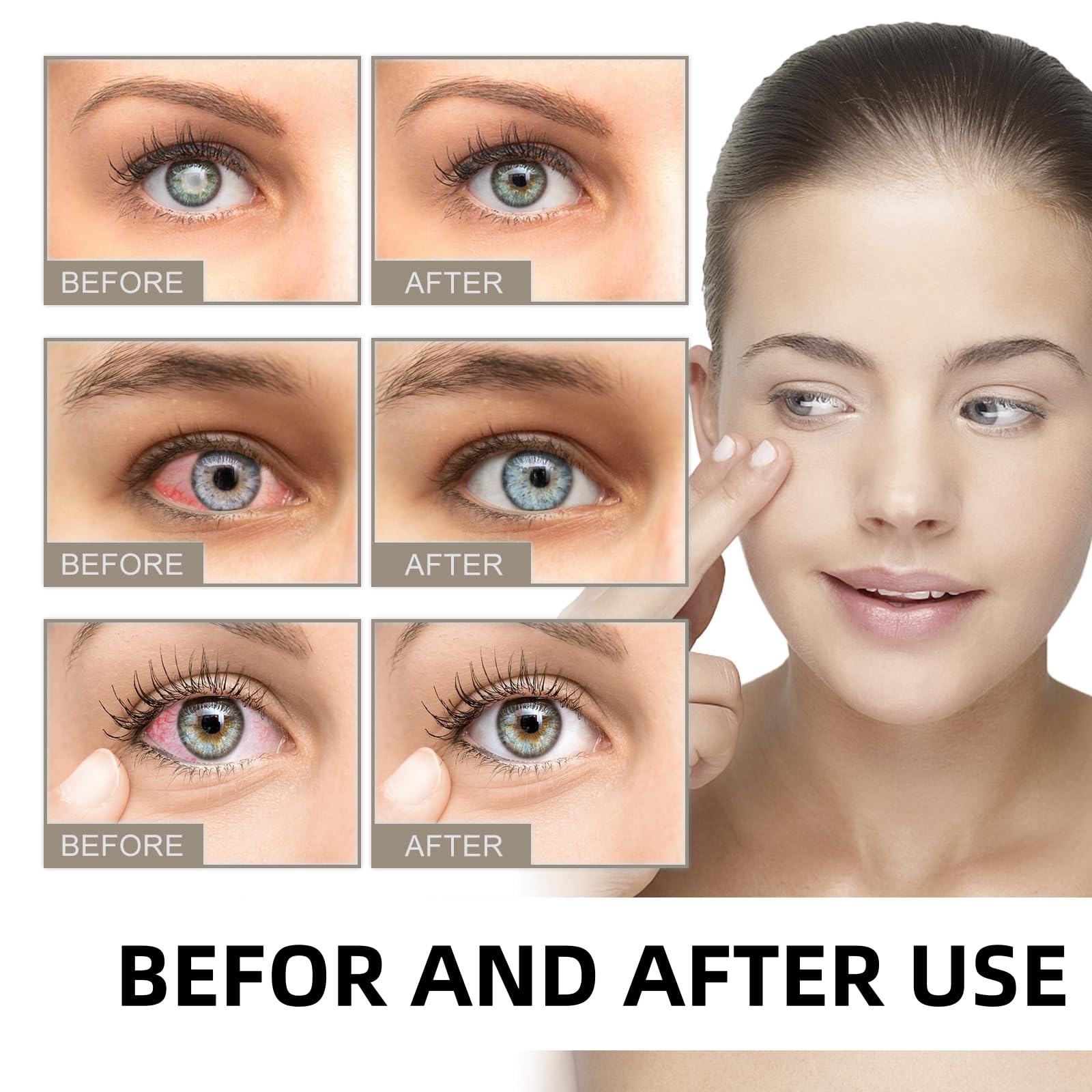 Honey Eye Drops,Honey for Eye,Stingless Bee Honey Eye Drops,Eye Drops ...