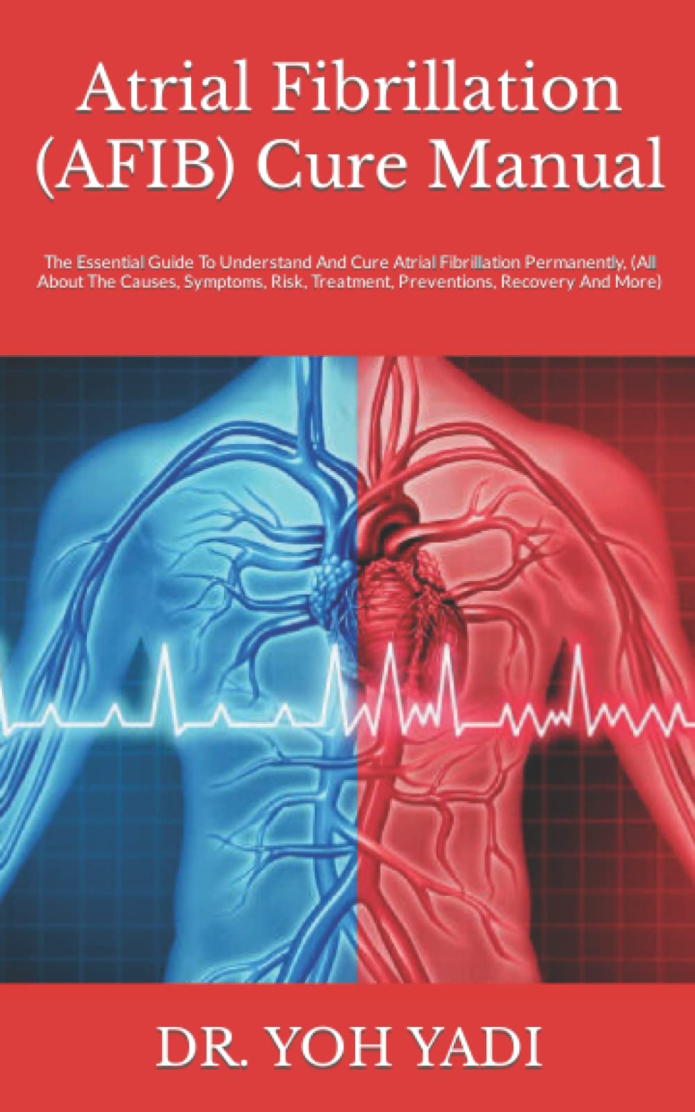 Buy Atrial Fibrillation (AFIB) Cure Manual: The Essential Guide To ...