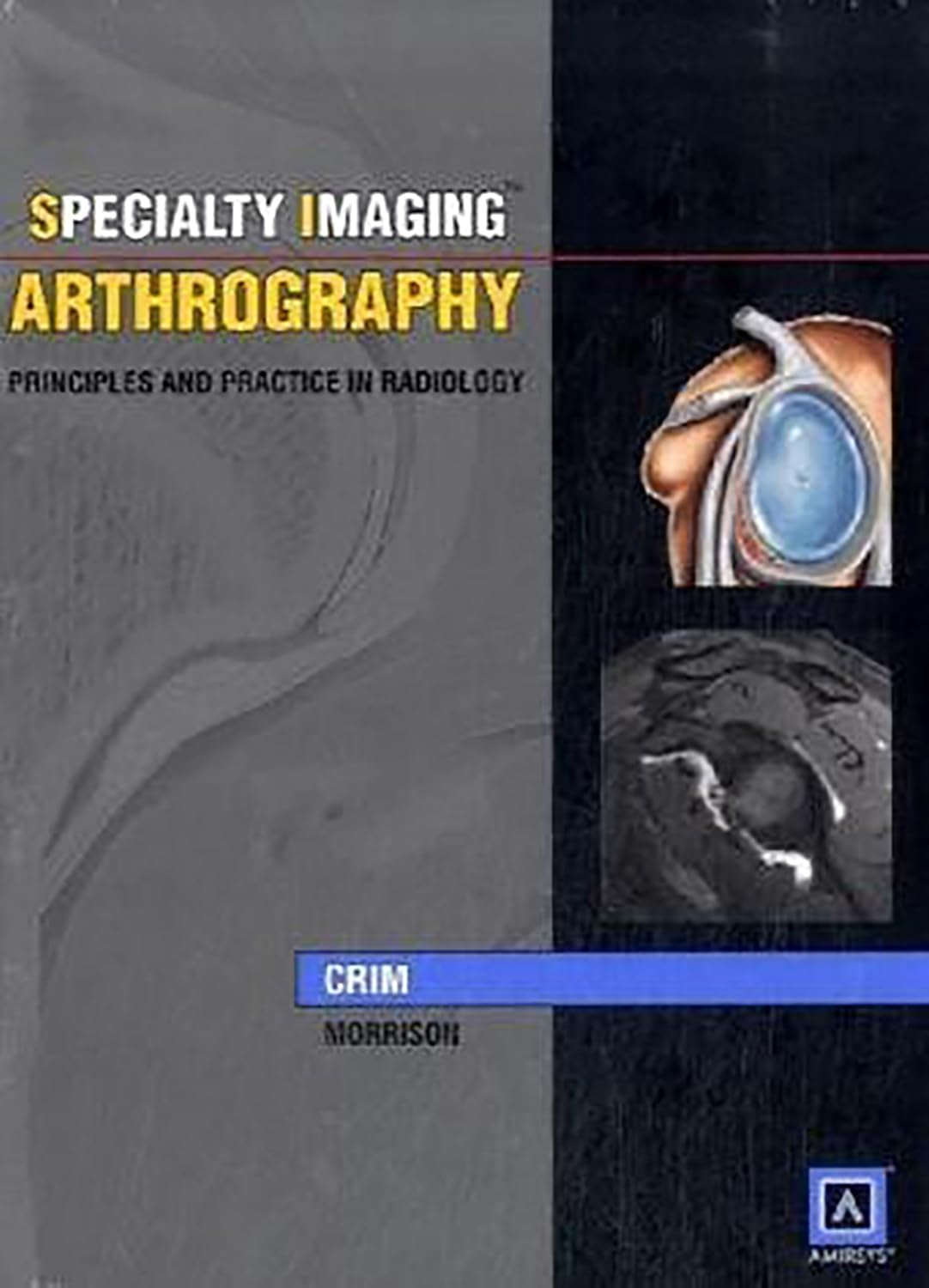 Specialty Imaging: Arthrography: Principles and Practice in Radiology ...