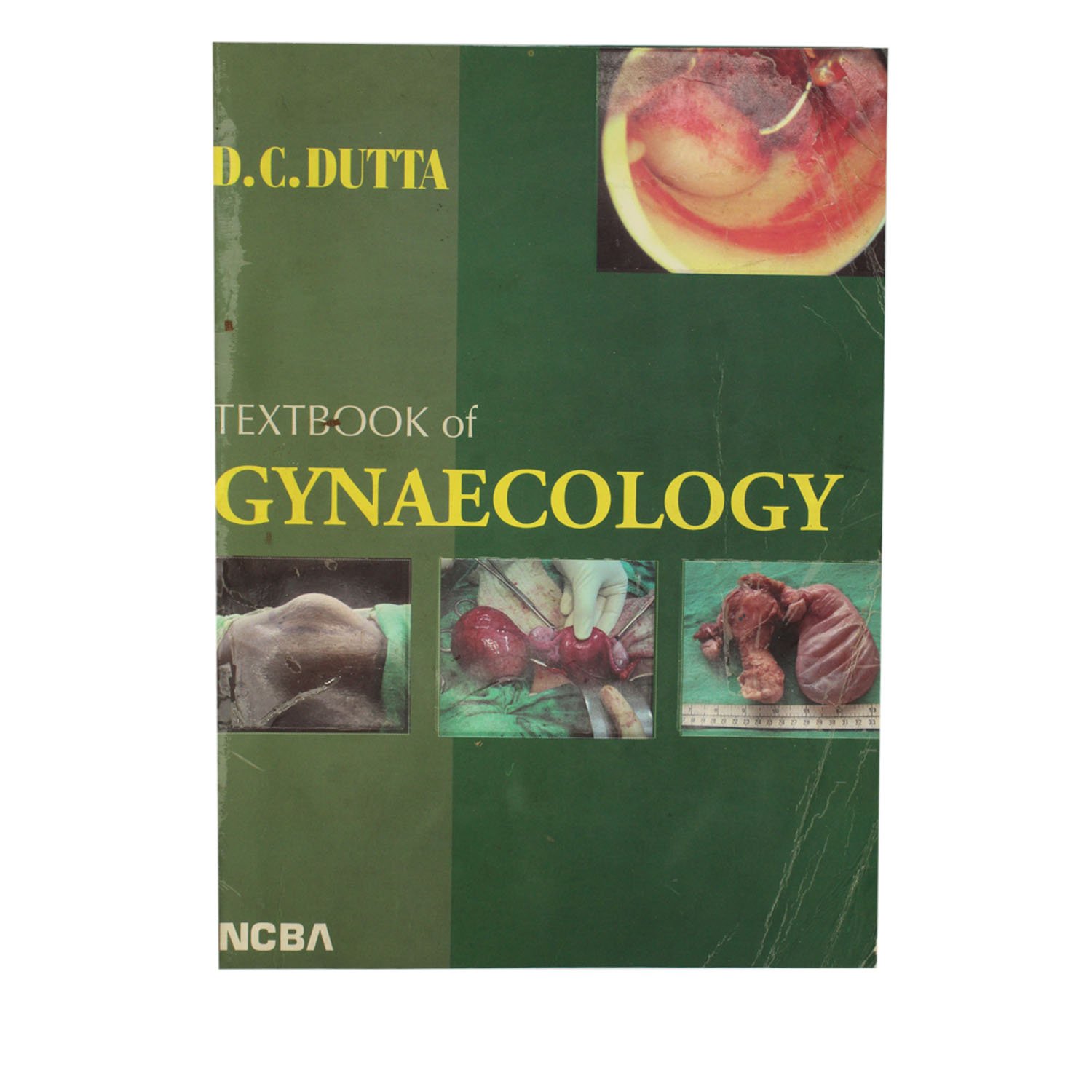 Buy Textbook of Gynaecology including Contraception Book Online at Low ...