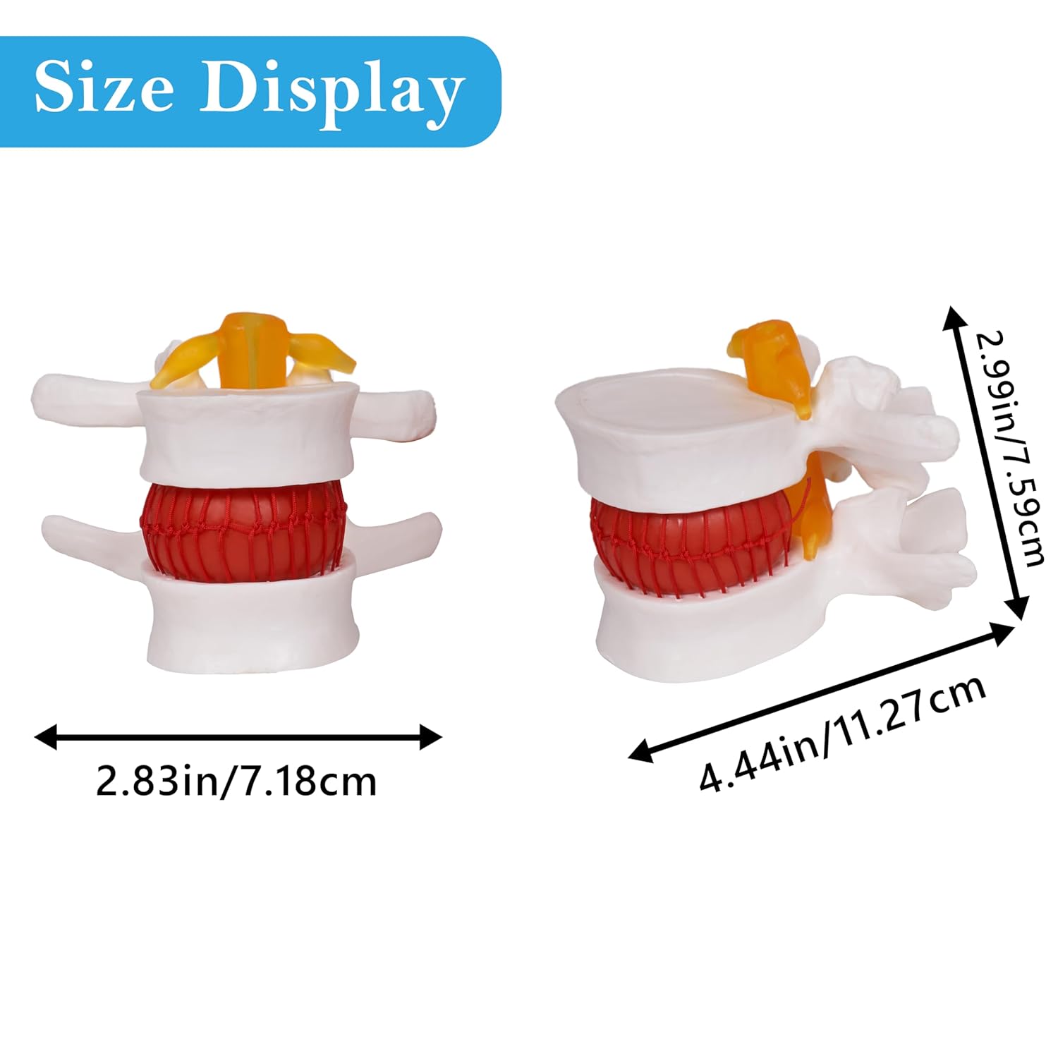 Human Anatomical Lumbar Disc Herniation Model, Australia | Ubuy
