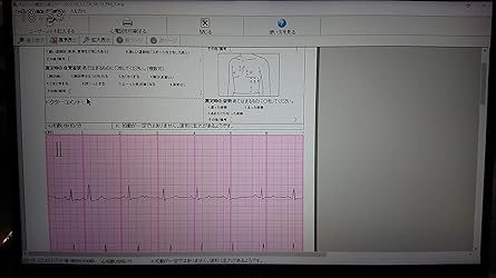 Amazon.co.jp: オムロンHCG-801用 心電図印刷ソフト HCG-SOFT-2 : パソコン・周辺機器