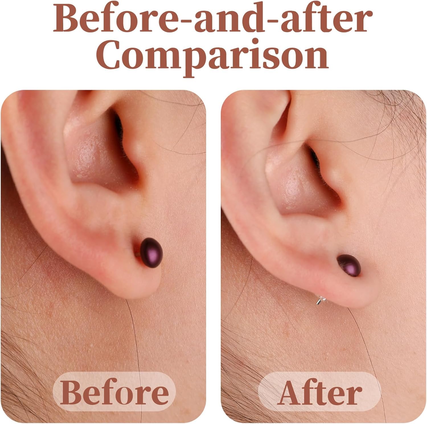 Heavy Earring Support 300-Pack – Invisible Lobe Lifters For Heavy ...