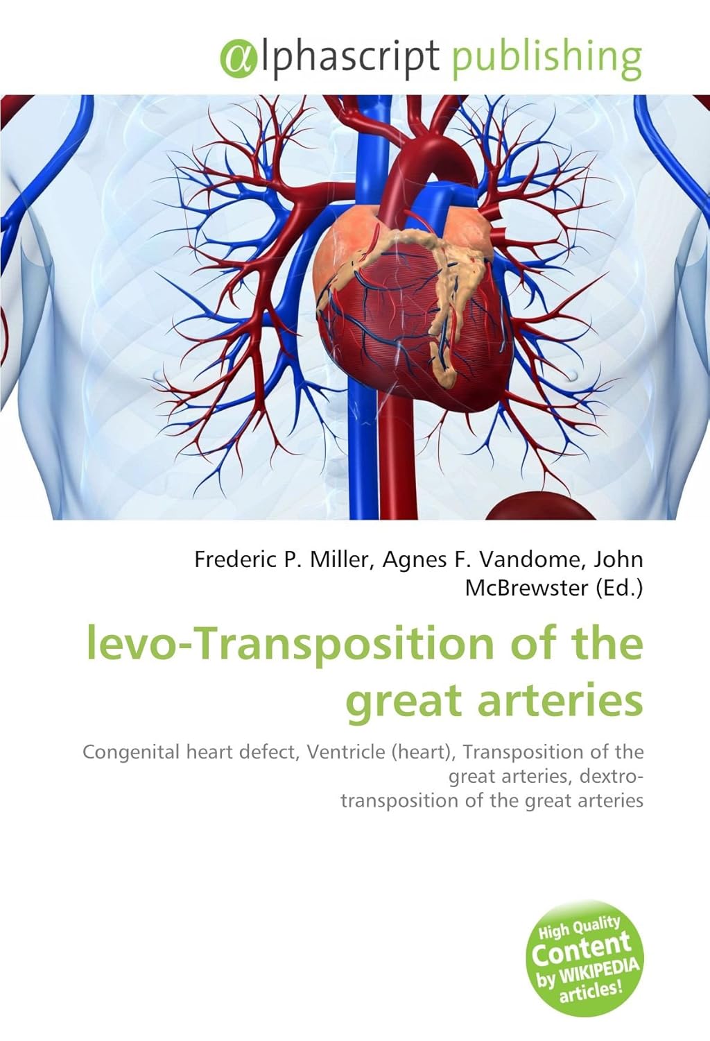 levo-Transposition of the great arteries: Congenital heart defect ...