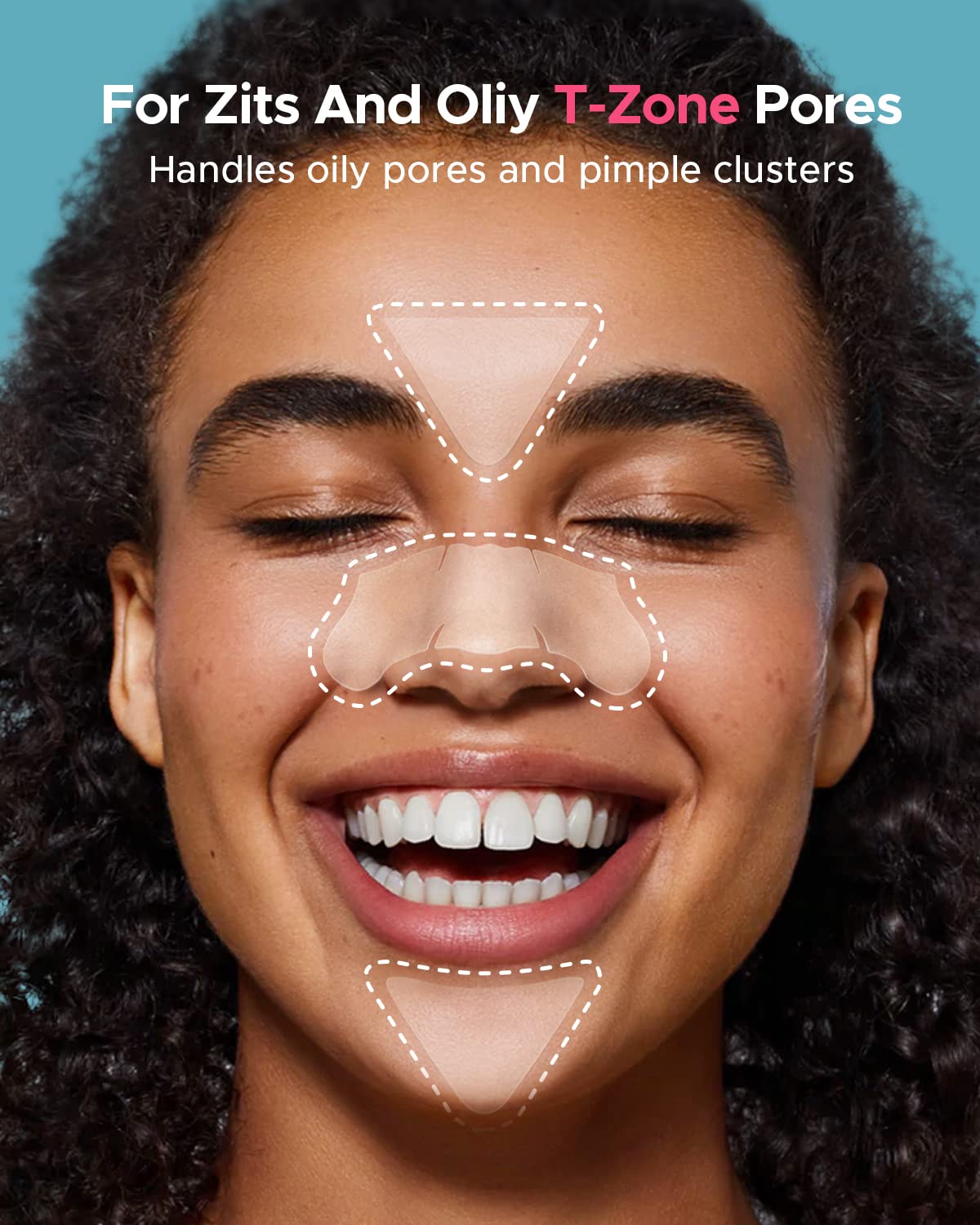 T Zone Acne How Acne Face Map Guides Breakout Prevention