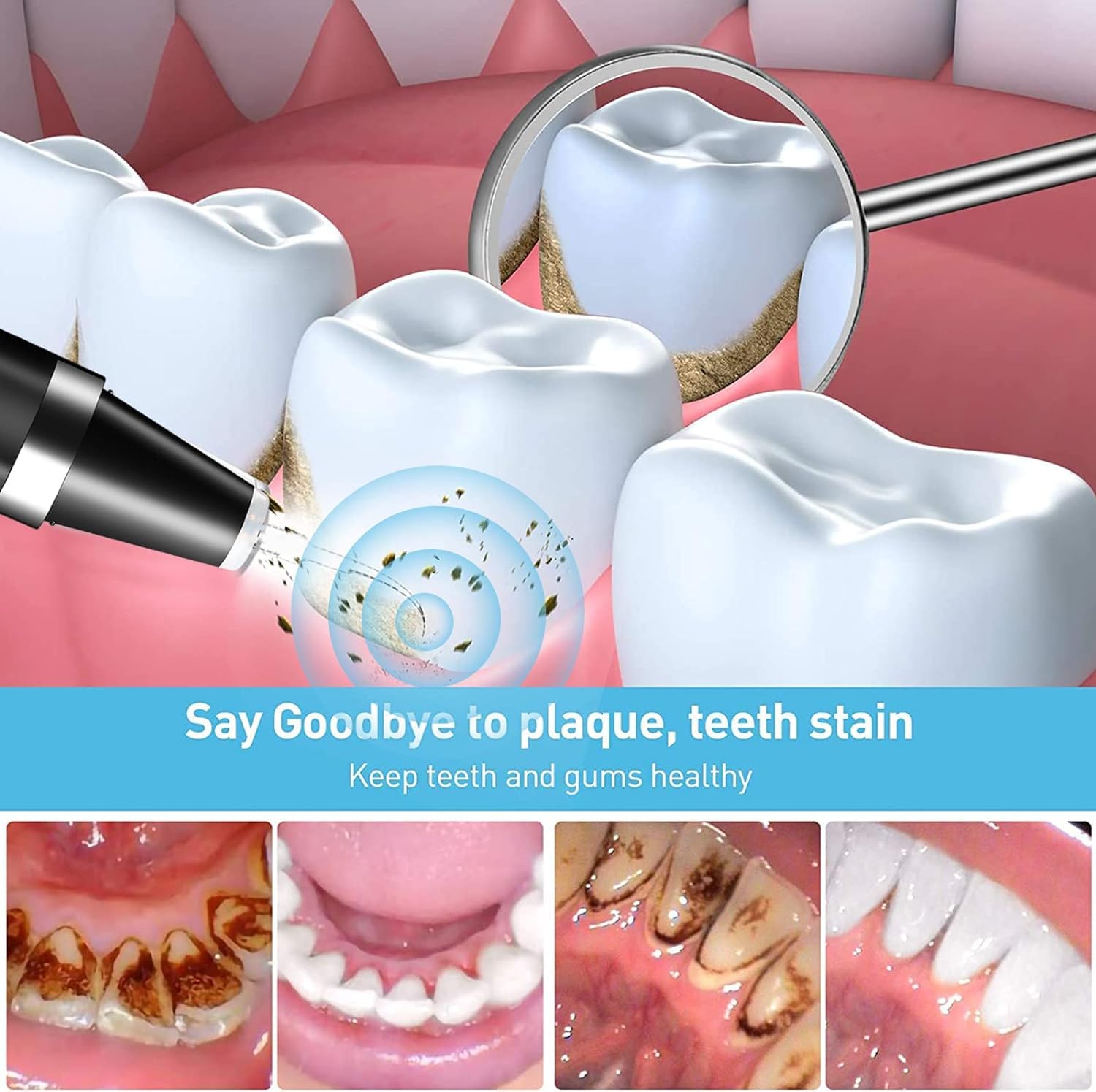 URTUE Electric Teeth Cleaning Tool, Dental Teeth Cleaner Cordless ...