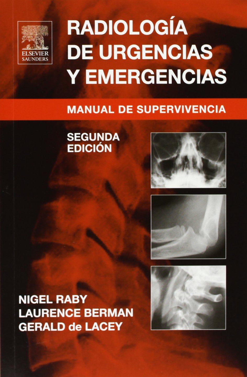 Radiologia de urgencias y emergencies: Manual De Supervivencia : Raby ...