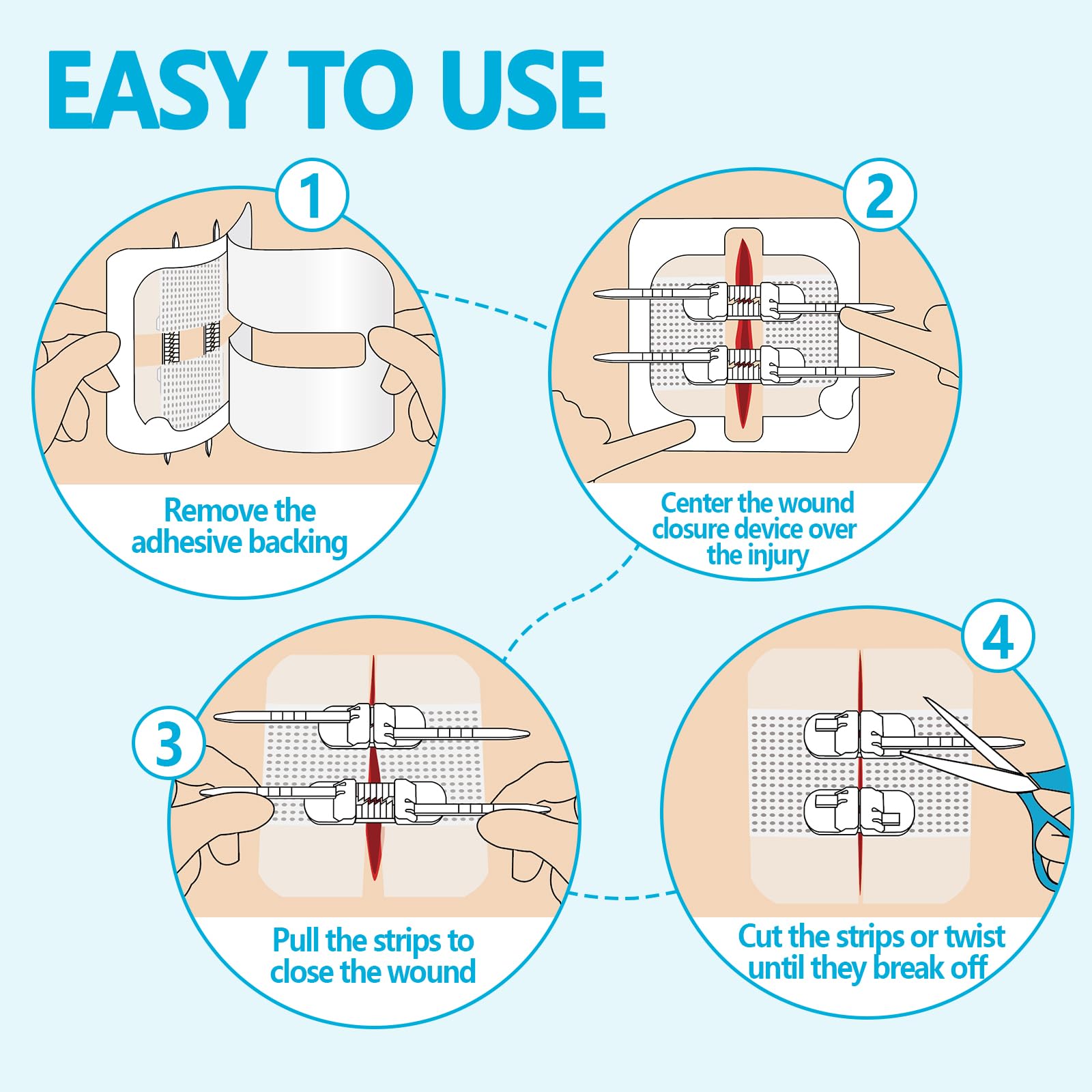 Snapklik.com : Senvok Emergency Wound Closure Device 4 Pcs - Upgraded ...