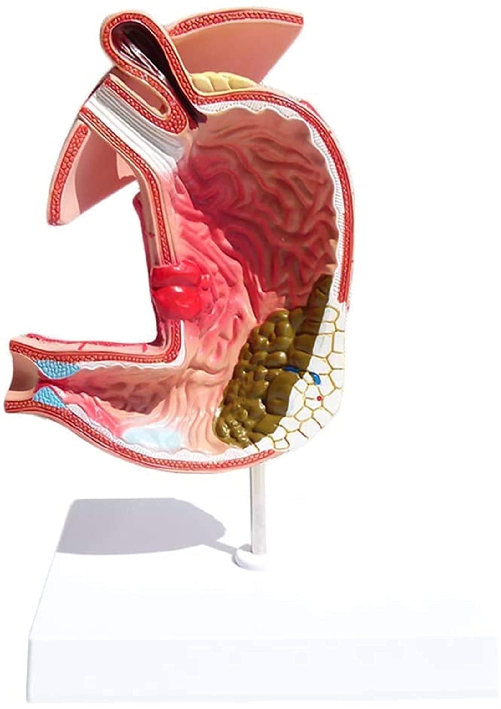 Buy aipipl Study Model Educational Model Stomach Anatomy Model tritis ...