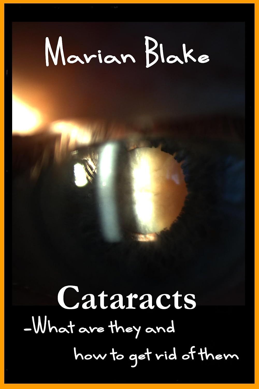 Amazon.com: Cataracts: What are they and how to get rid of them? (Your ...