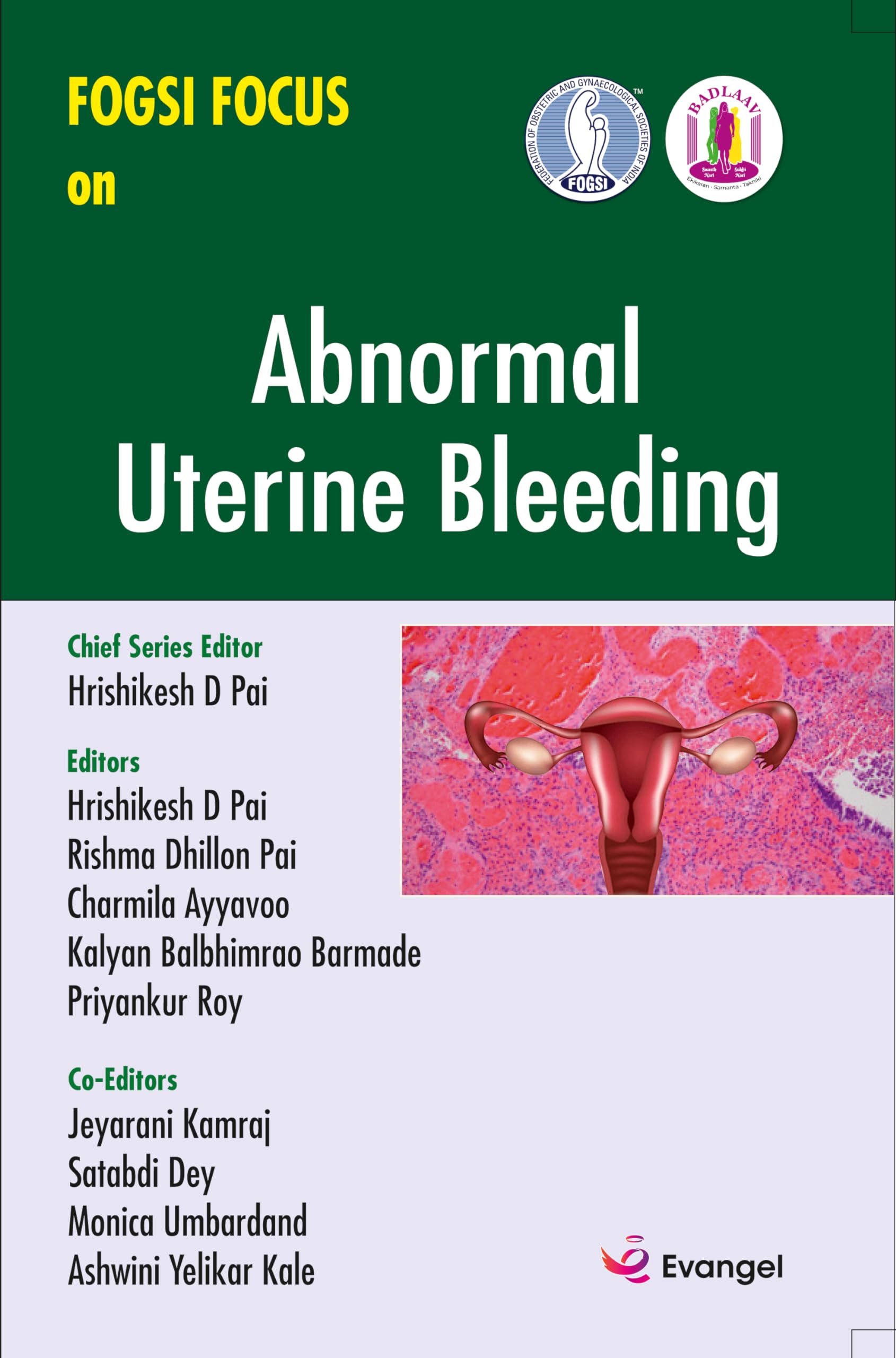 Buy FOGSI FOCUS on Abnormal Uterine Bleeding Book Online at Low Prices ...