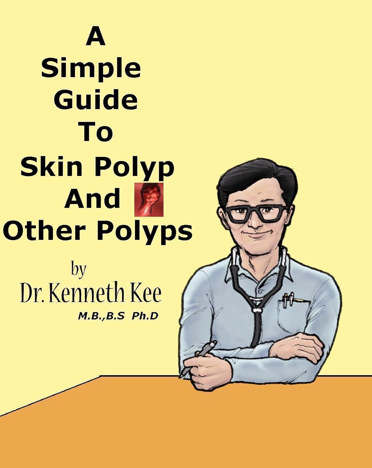 A Simple Guide to Skin Polyp and Other Polyps (A Simple Guide to ...