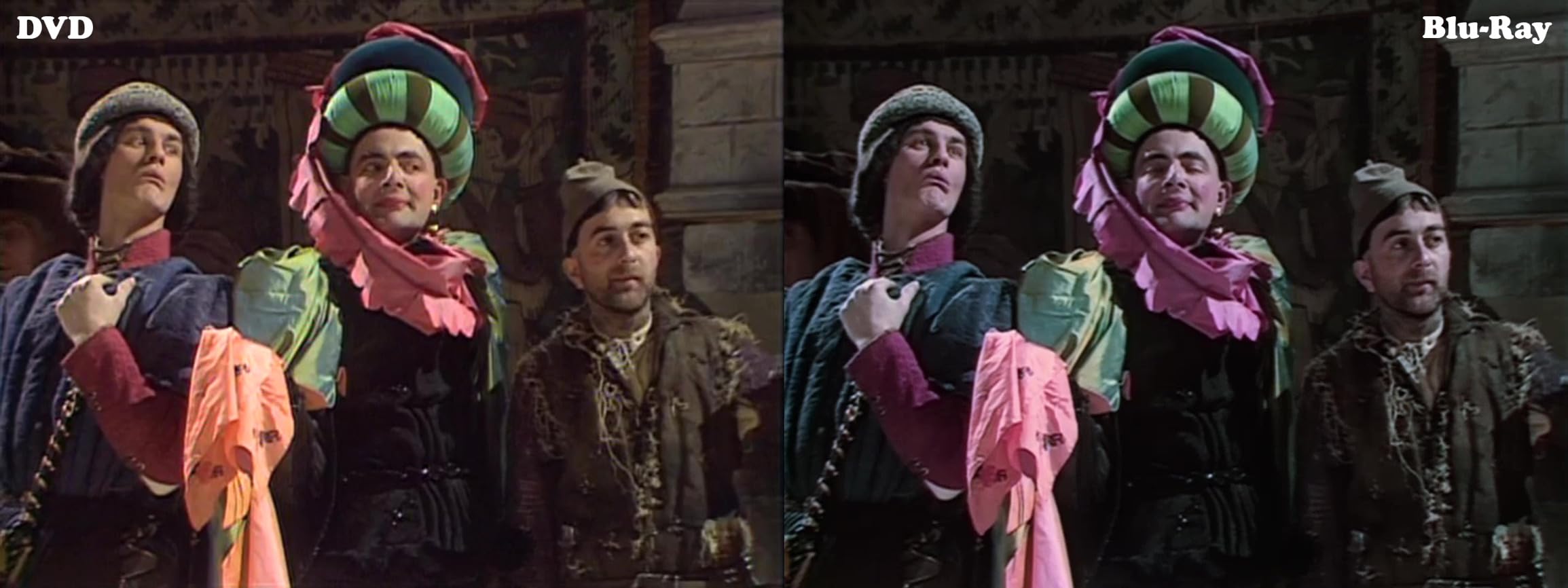 Amazon.com: Blackadder: The Complete Collection [Blu-Ray] : Movies & TV