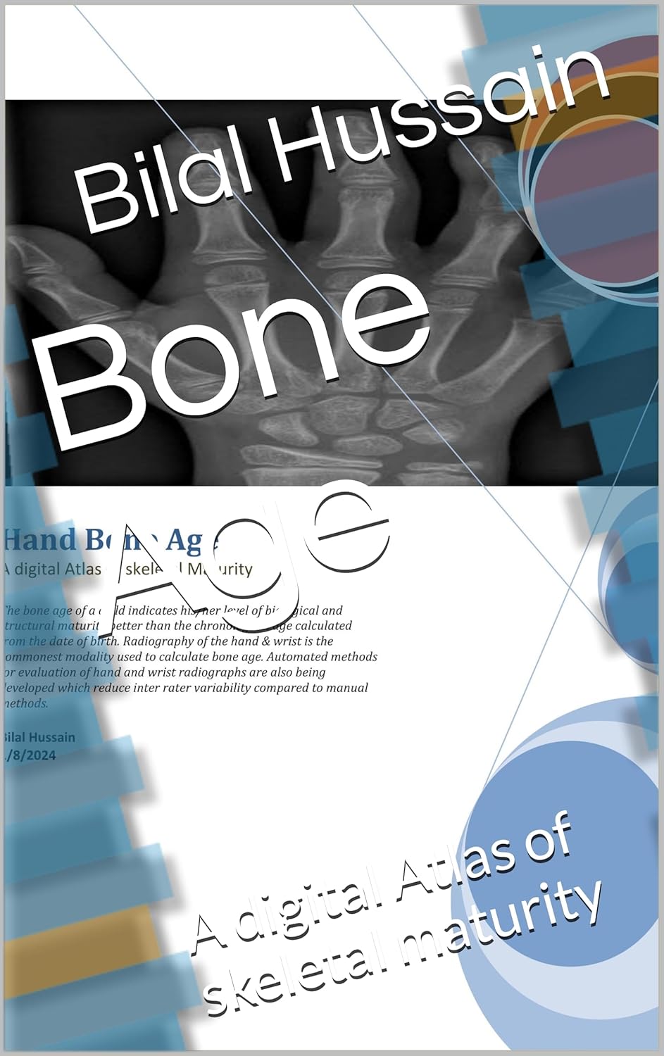 Amazon.com: Bone Age: A digital Atlas of skeletal maturity eBook ...